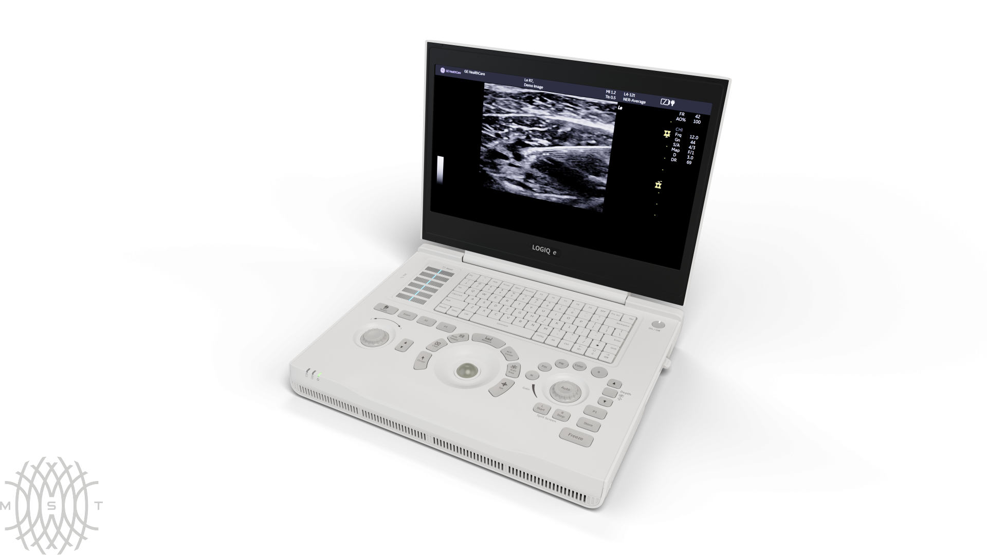 Портативная ультразвуковая система GE HealthCare Logiq e купить в ...