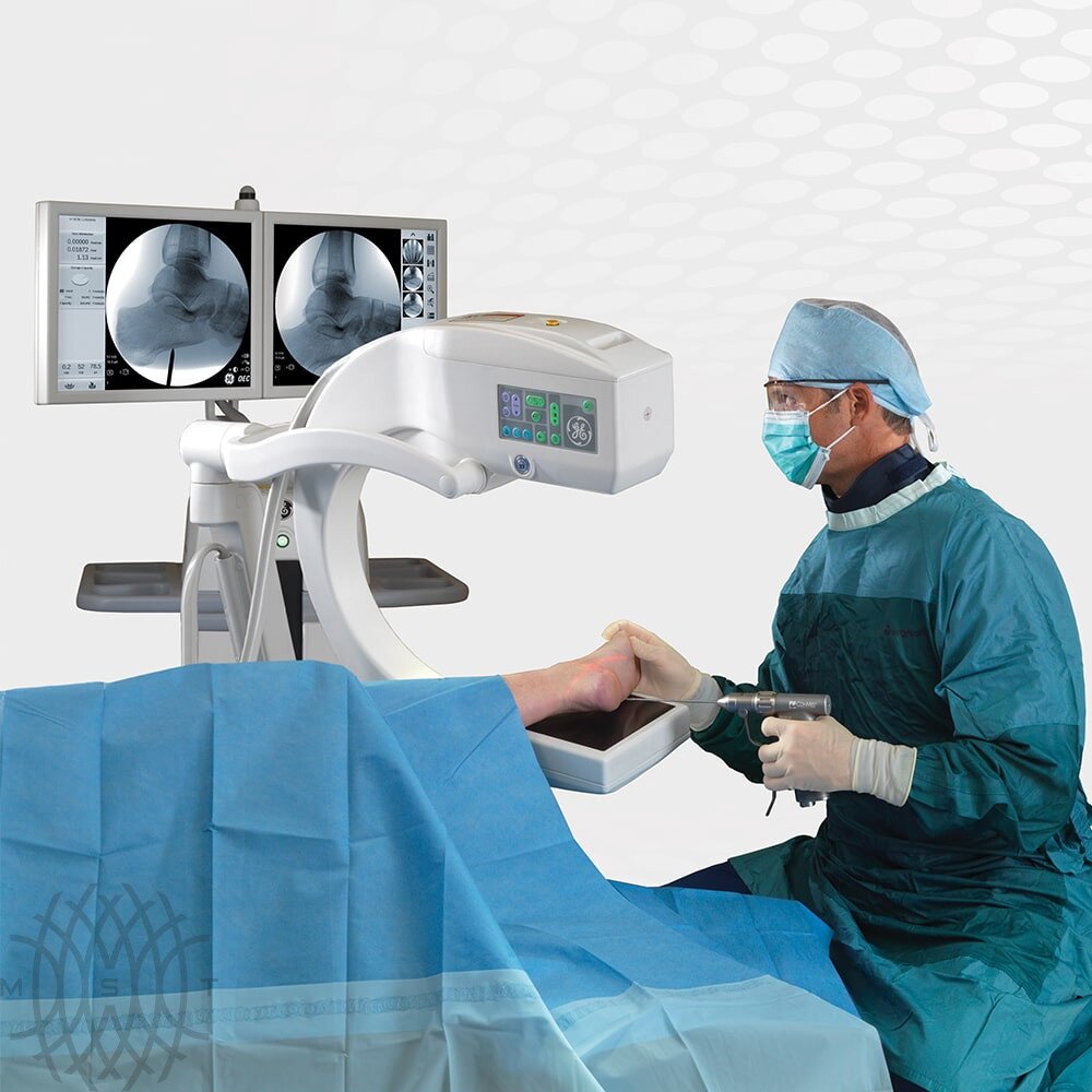 GE OEC Miniview мобильный рентген аппарат типа C-дуга купить в Москве ...