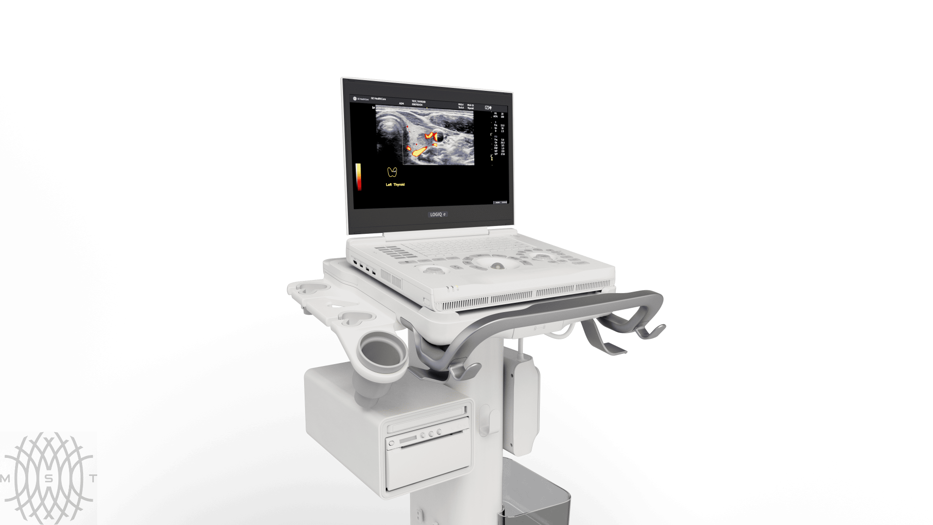 Портативная ультразвуковая система GE HealthCare Logiq e купить в ...